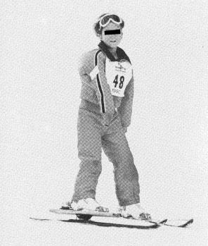 Fig 36C-3. Multiple-limb deficiencies do not r | O&P Digital Resource ...